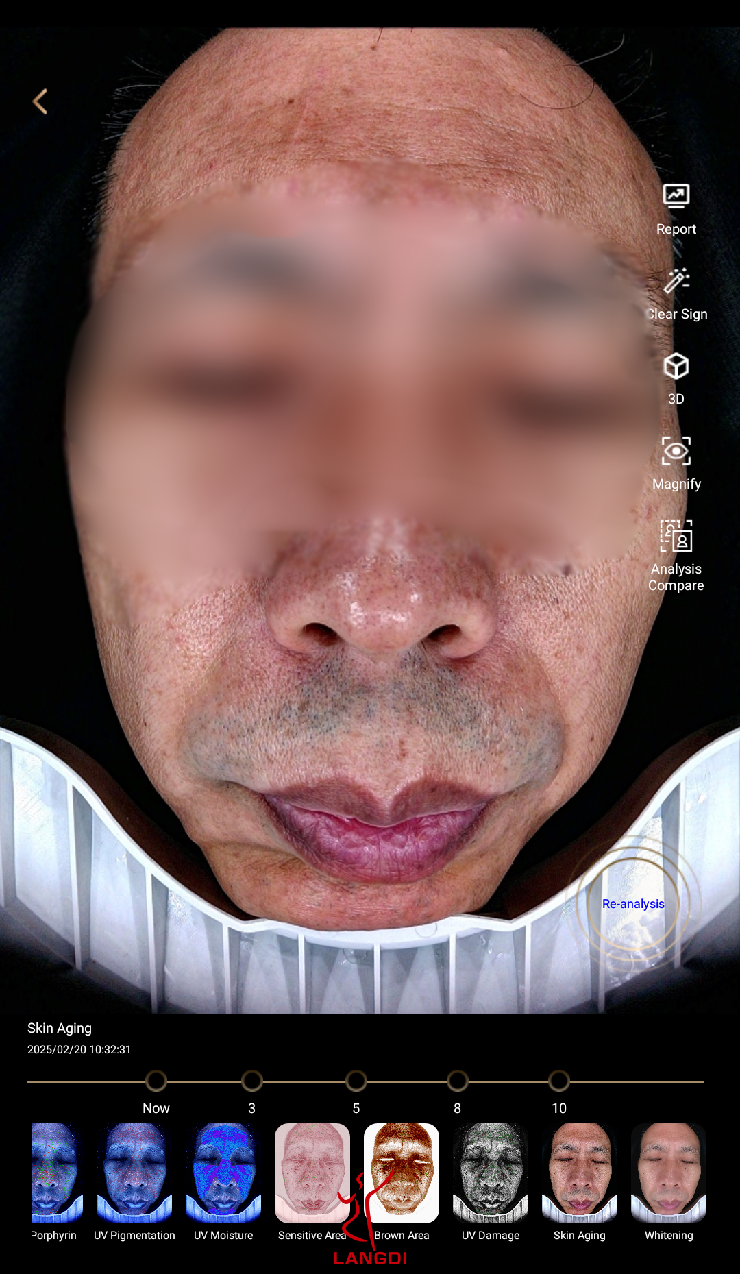 AI in Skin Analyzer: Revolutionizing Skincare with Technology ...